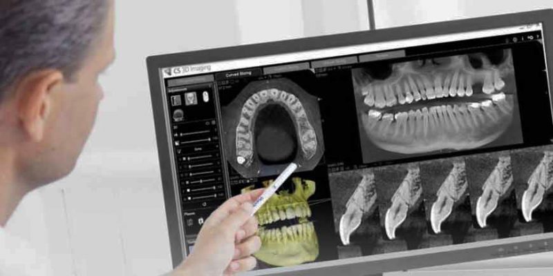 Importance of CBCT 3D Scanner in Implant Dentistry - DENTAL VIP Posts